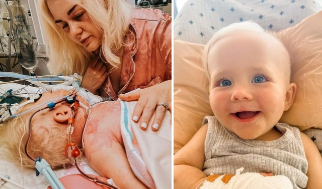 Bebê precisa amputar as duas pernas depois de contrair bactéria Strep A