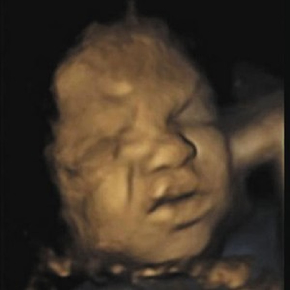 Bebês fazem cara de choro e sorriem dentro da barriga da mãe