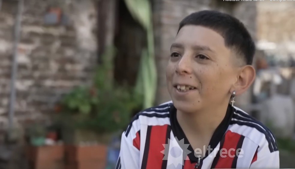 Ele parece criança, mas tem 31 anos: conheça Claudio, homem que tem a ...