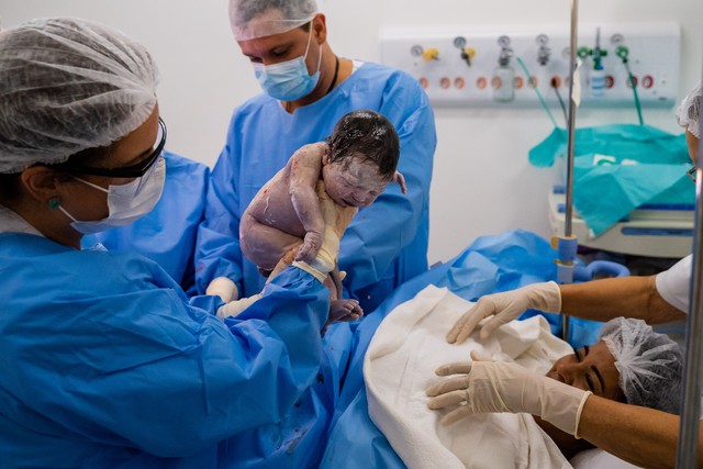 Bebê nasce empelicado no RJ; confira as fotos