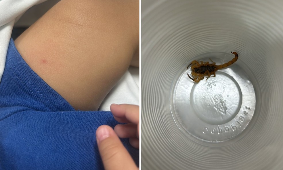 'Trauma muito grande', diz mãe de menino de 1 ano e meio picado por ...