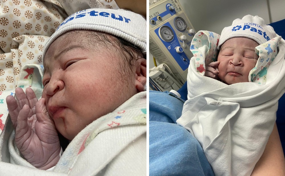 Bebê nasce com nariz achatado e mãe brinca em post viral: “Rinoplastia ...