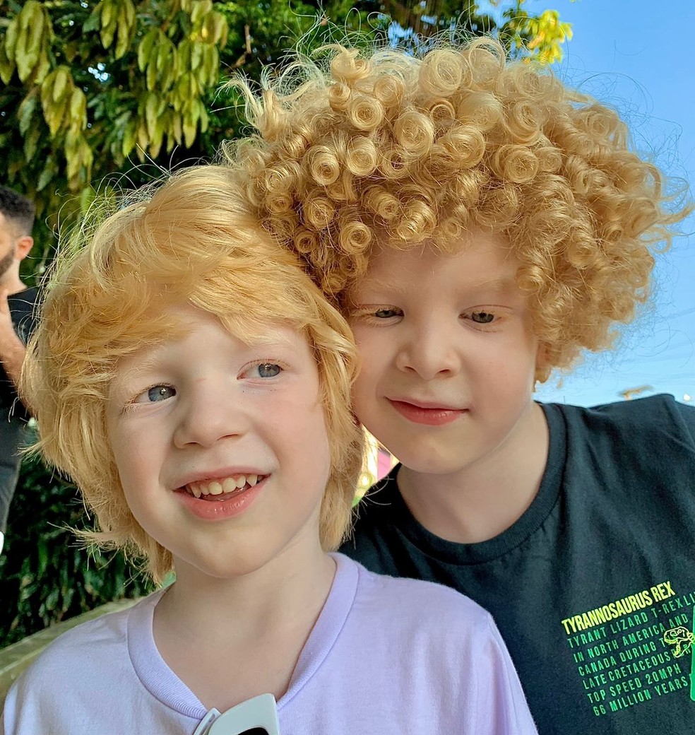 Albinismo: conheça 4 crianças brasileiras com uma beleza única