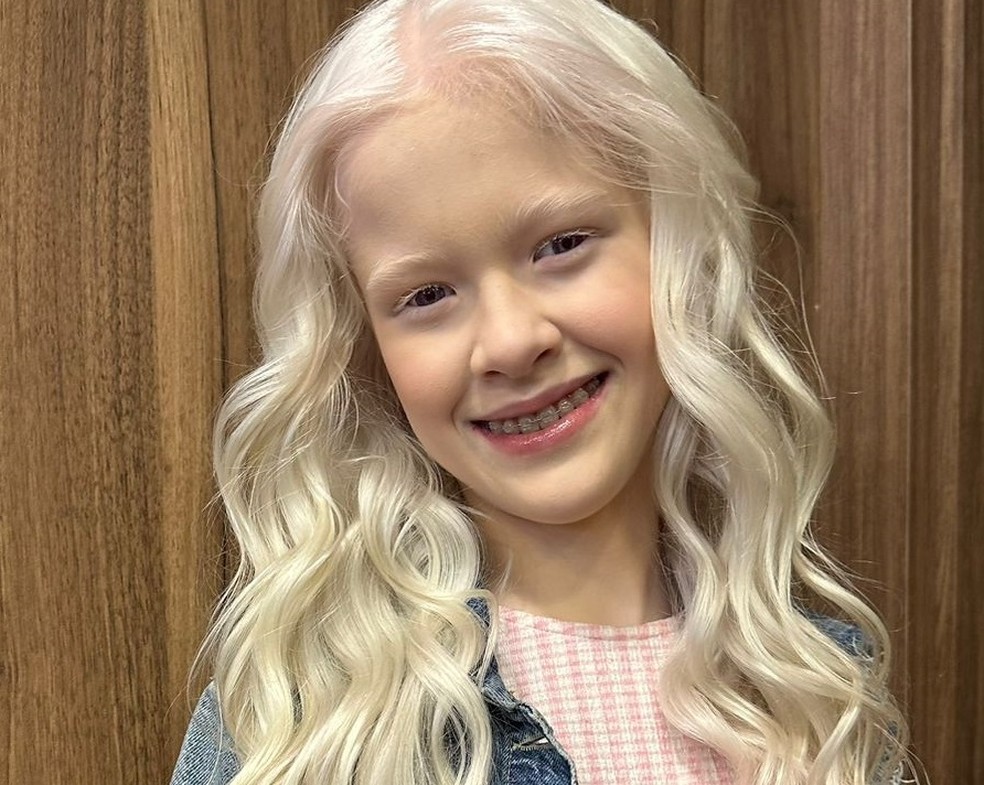 Menina 10 anos com albinismo faz sucesso na web: 'Ela ama ser diferente'