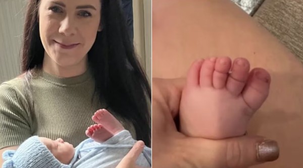 Bebê quase perde os dedos do pé por um detalhe que todo mundo ignora na ...