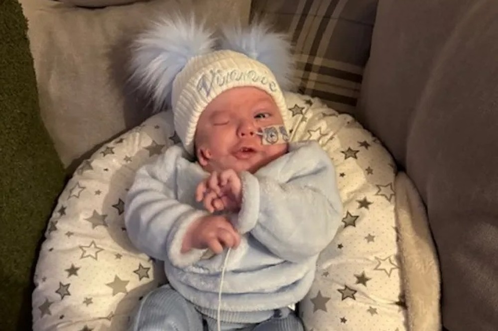 Bebê com síndrome rara nasce sem um olho e com orelha na bochecha