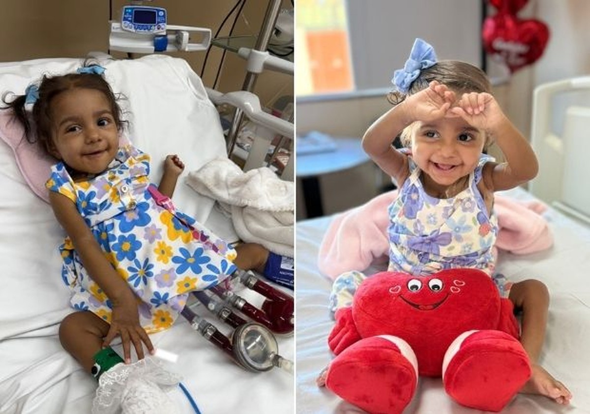 Bebê passa por transplante após viver com coração artificial: 'Coração ...