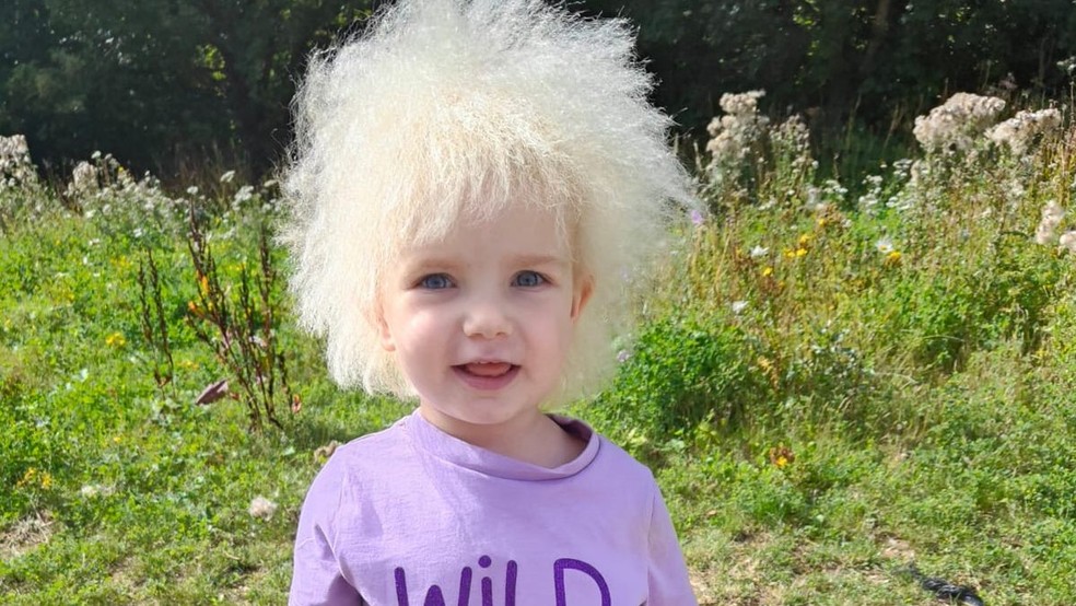 'Fofa': Menina com 'cabelo impenteável' recebe apelido carinhoso dos ...