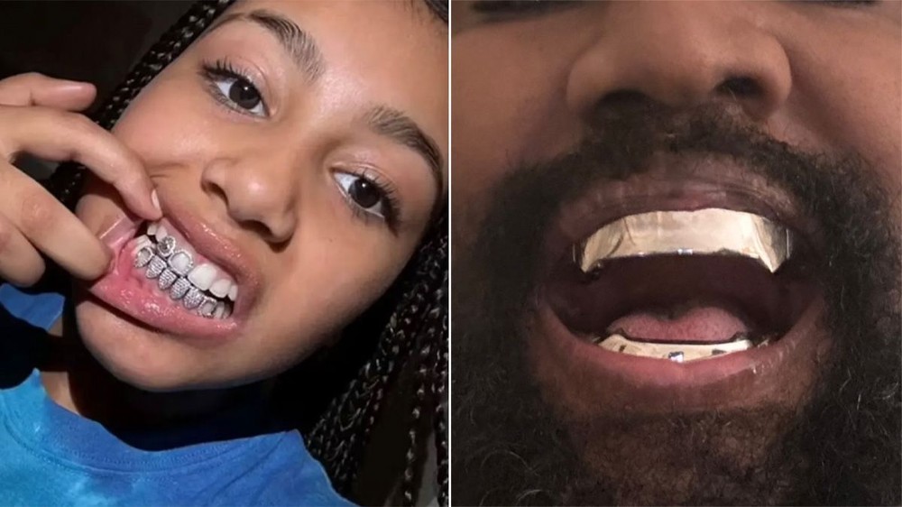 Filha de Kanye West exibe diamantes nos dentes após rapper gastar ...