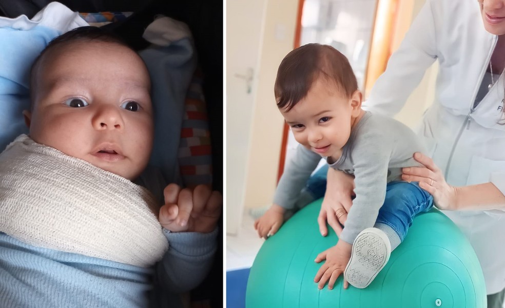 Bebê sofre lesão durante o parto e fica com braço paralisado, no RS ...