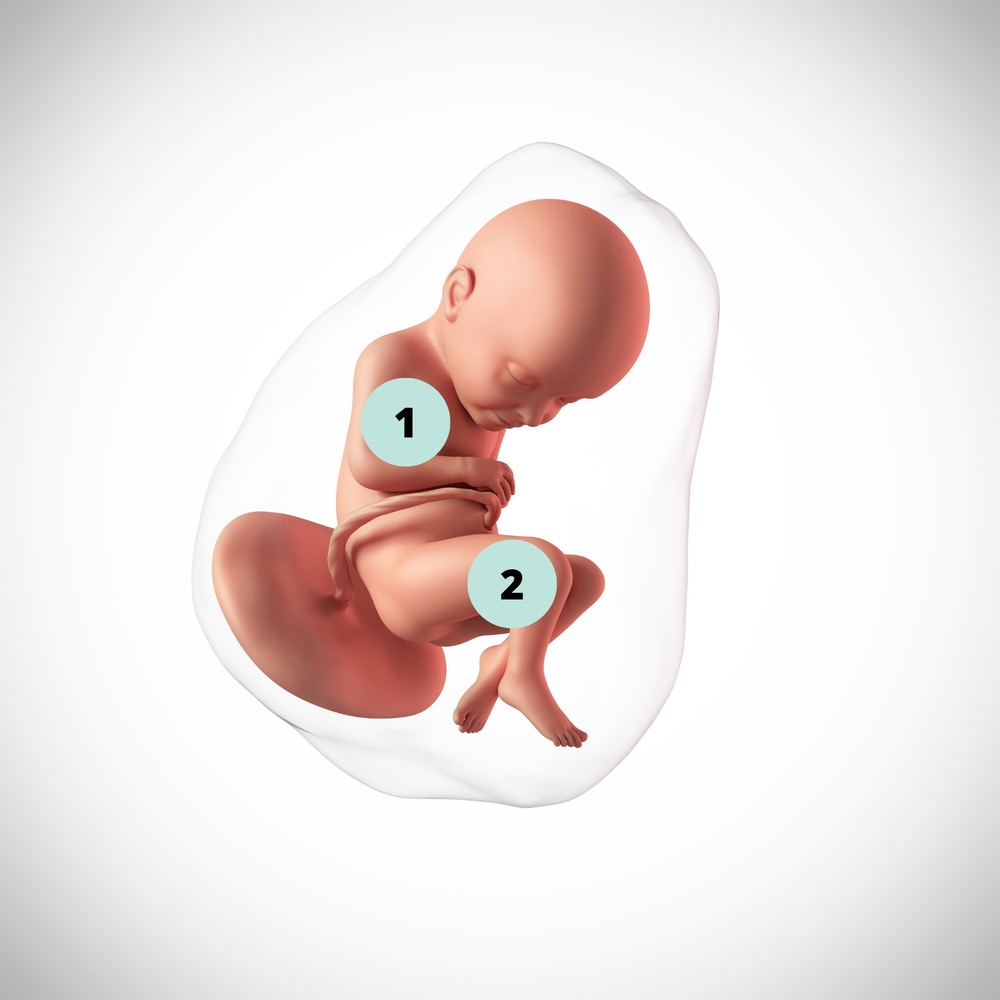 32 semanas de gravidez