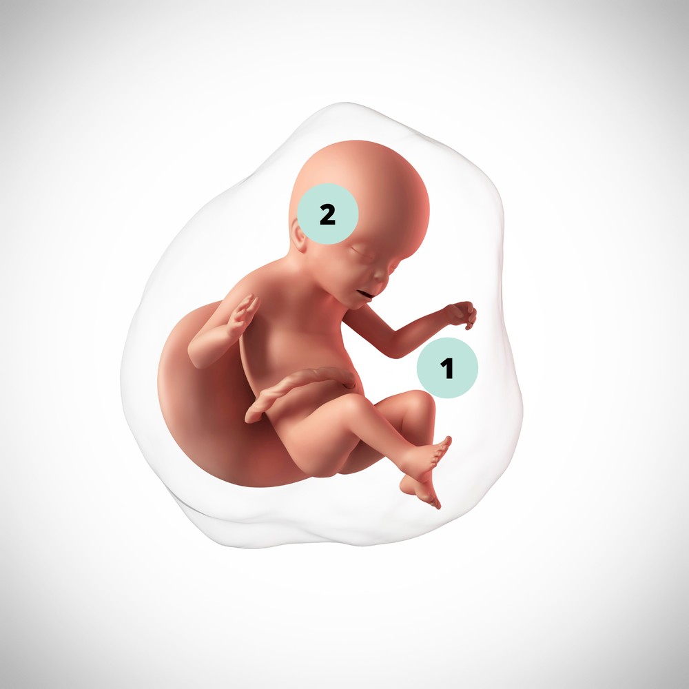23 semanas de gravidez