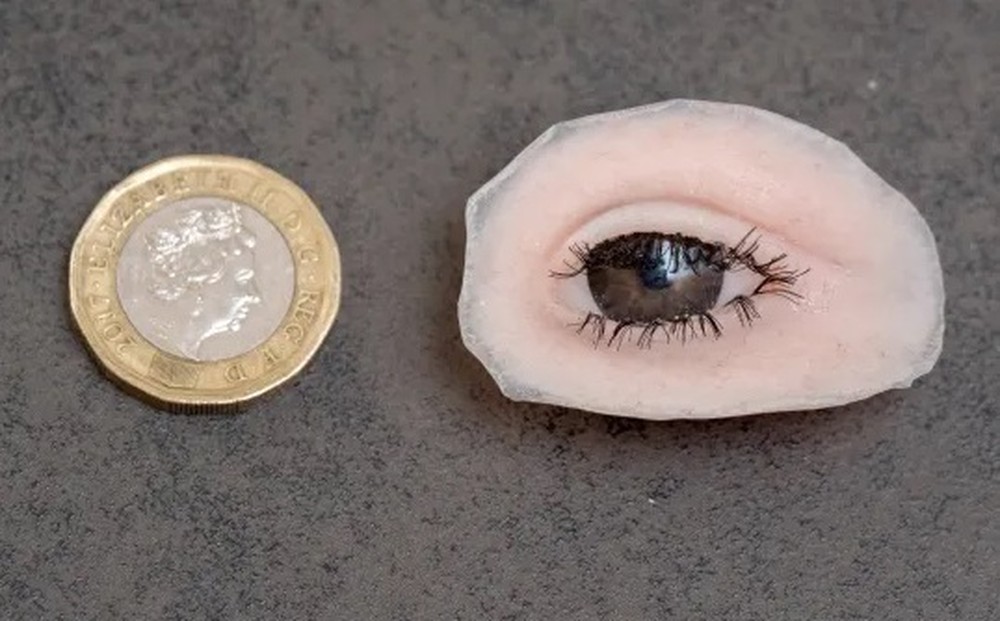 Menina de 1 ano recebe prótese ocular após perder olho para câncer: 'As ...