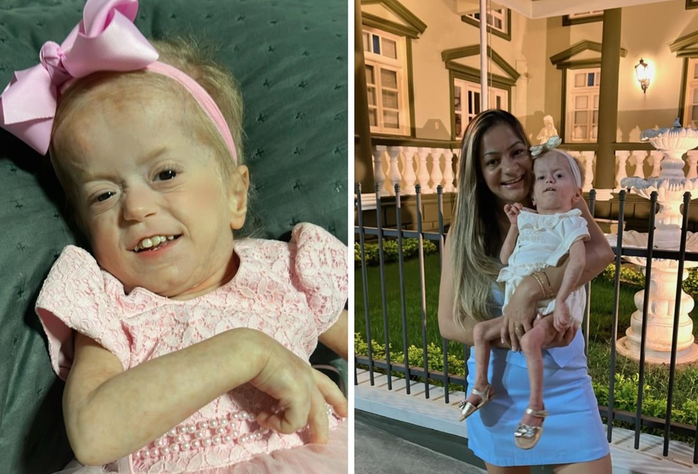 “Já me perguntaram por que não abortei”, desabafa mãe de menina de 6 anos com síndromes raras