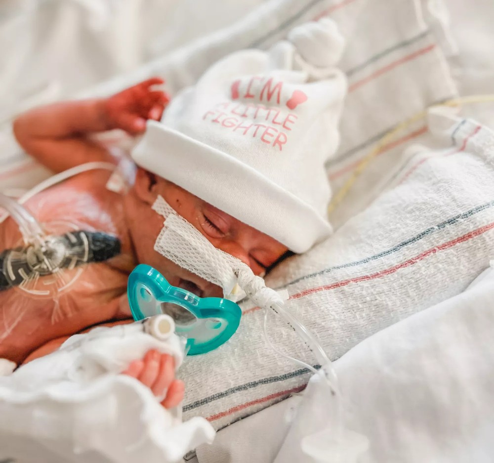 Bebê que nasceu pesando apenas 900 gramas recebe alta após cinco meses ...