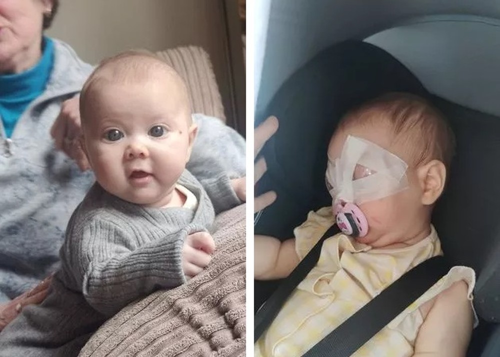 Olho azul de bebê faz sucesso, mas mãe descobre que era sinal de ...