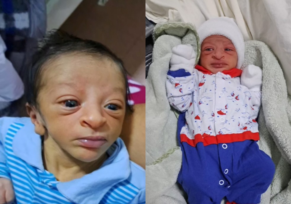 Mãe mostra antes e depois do filho e revela: 'Ele nasceu feio, mas ...