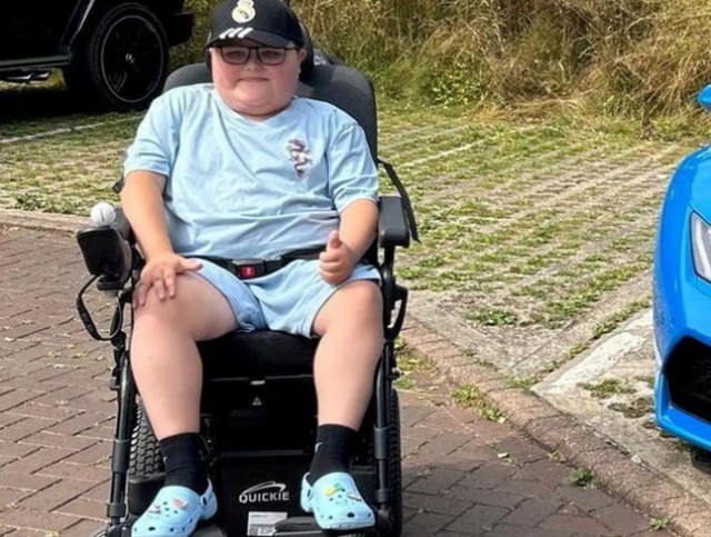 Benjamin Button da vida real: doença faz menino envelhecer “ao contrário’