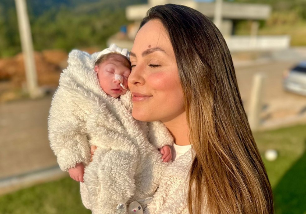 Bebê nasce com condição rara que afeta o crânio e supera expectativas ...