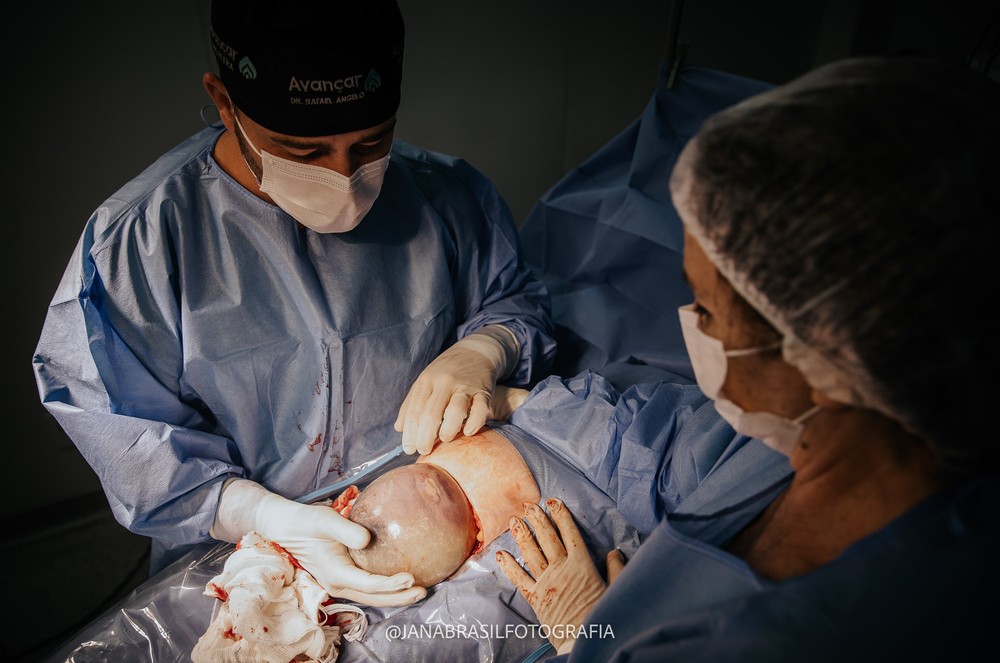 Bebê nasce empelicado no ES e fotos surpreendem