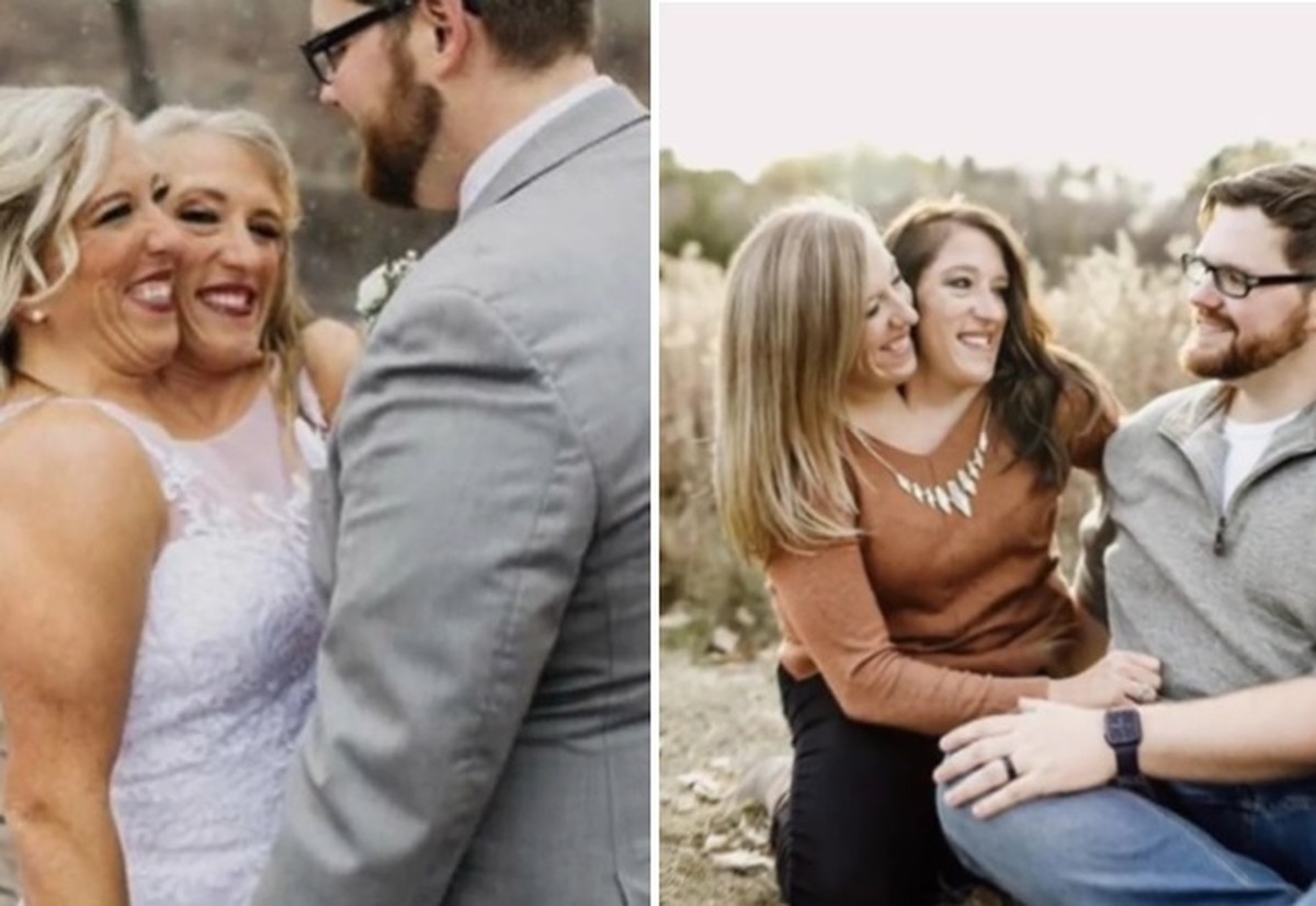 Gêmea siamesa está casada, apesar de ainda viver unida à irmã ...