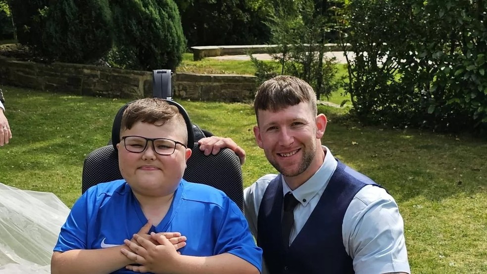 Benjamin Button da vida real: doença faz menino envelhecer “ao contrário’