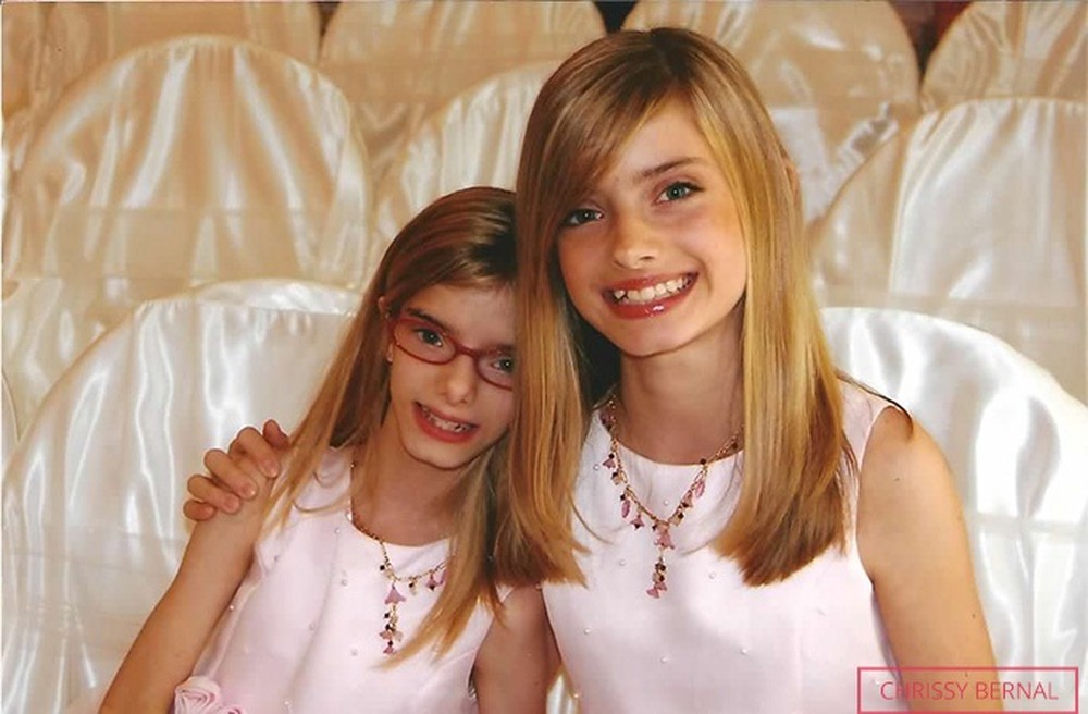 Conheça a história das gêmeas idênticas, mas 'diferentes' — uma delas ...