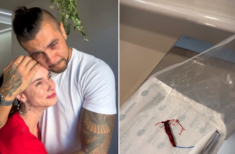 Aos 39 anos, atriz engravida do terceiro filho usando DIU: 'Não ...