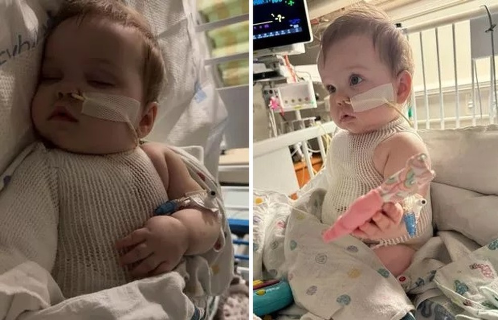 Bebê sofre queimaduras de terceiro grau no corpo todo, em creche