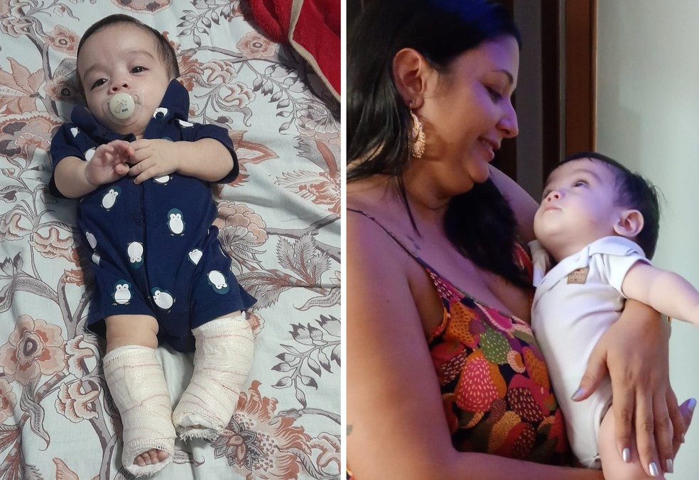 'Pensar no futuro me traz sofrimento', diz mãe de bebê com tipo raro de ...