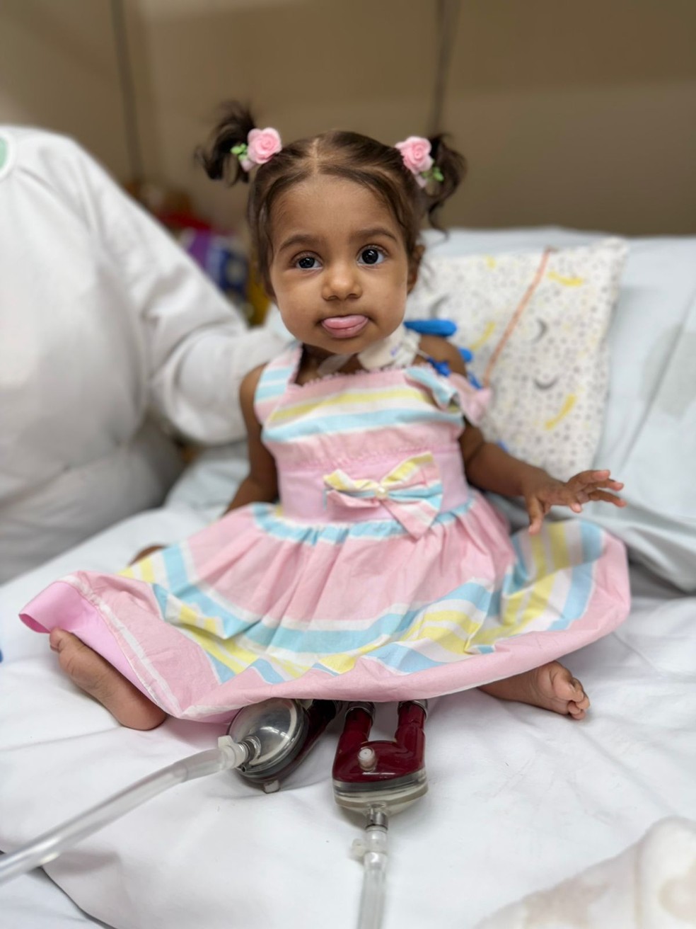 Bebê passa por transplante após viver com coração artificial: 'Coração ...