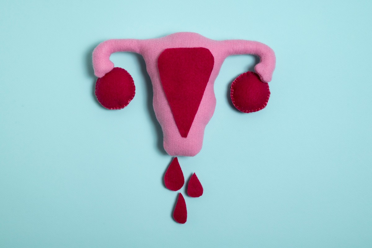 Quanto tempo demora pra vir a menstruação depois da curetagem?