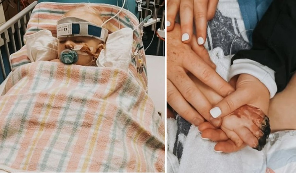 Bebê precisa amputar as duas pernas depois de contrair bactéria Strep A