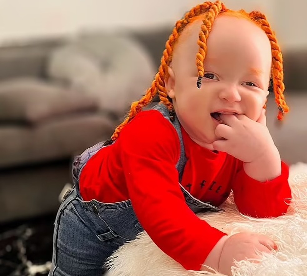 Bebê albino com cabelos ruivos e pais negros faz sucesso nas redes sociais