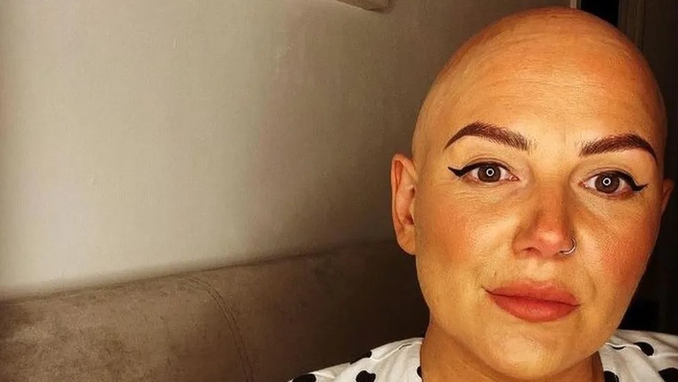 Mãe desabafa sobre insegurança por causa de alopecia: 'achei que nunca ...
