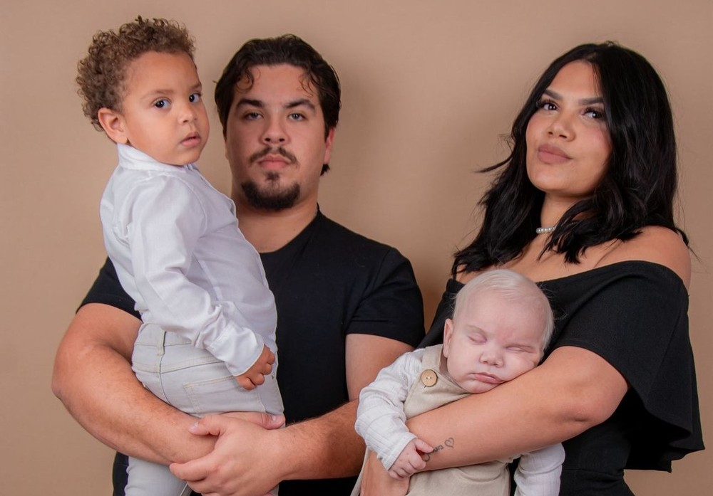 'Quando o vi, senti muito medo', conta mãe de bebê albino ao descobrir ...