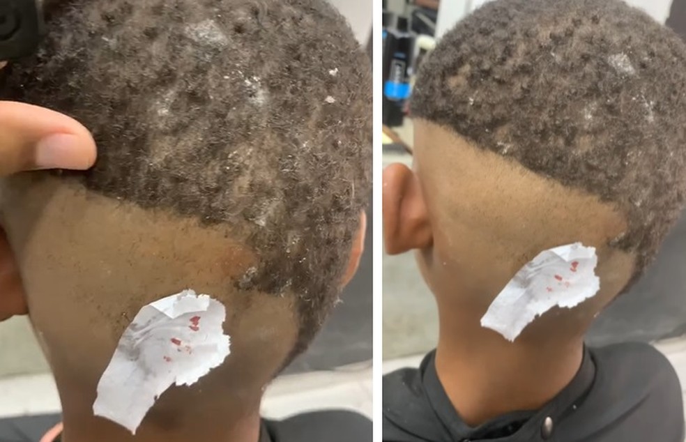 Barbeiro faz alerta sobre cabelo maluco após atender menino com cola ...