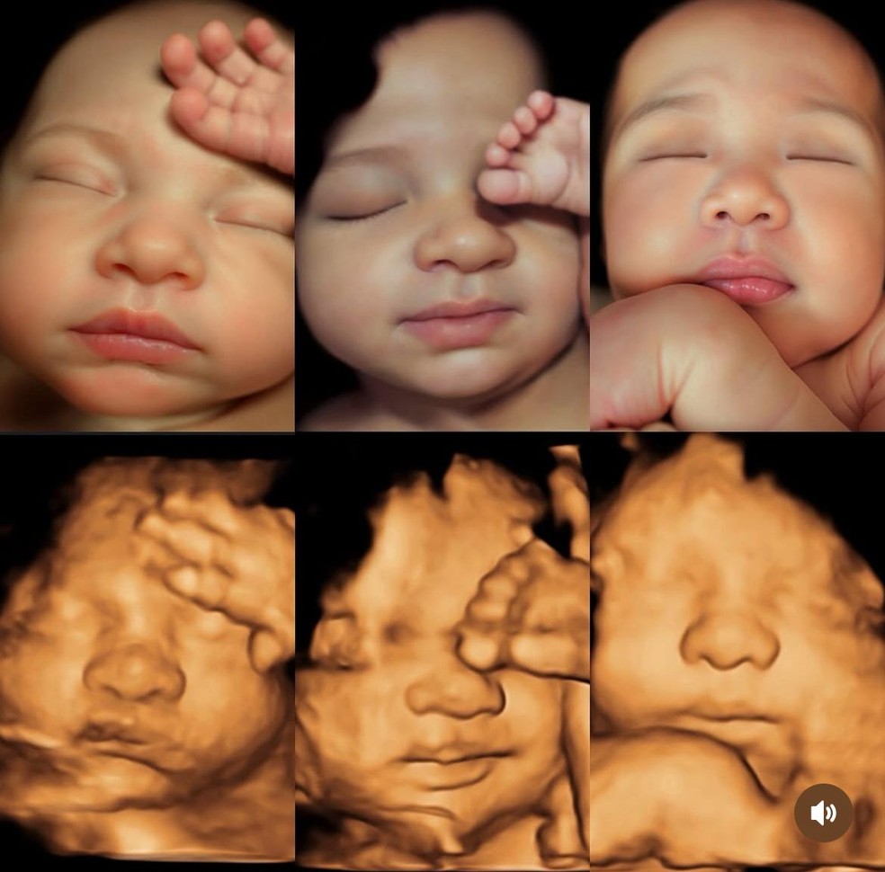 Ultrassons em 8K e com IA elevam a experiência visual a um novo nível ...